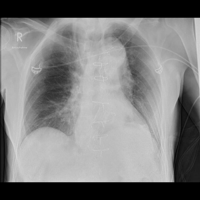 Clinical Image Gallery - Canon Medical Components Europe