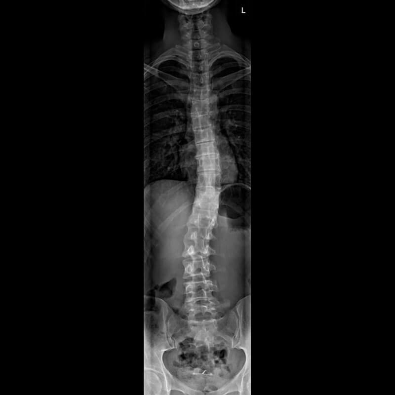 Clinical Image Gallery - Canon Medical Components Europe