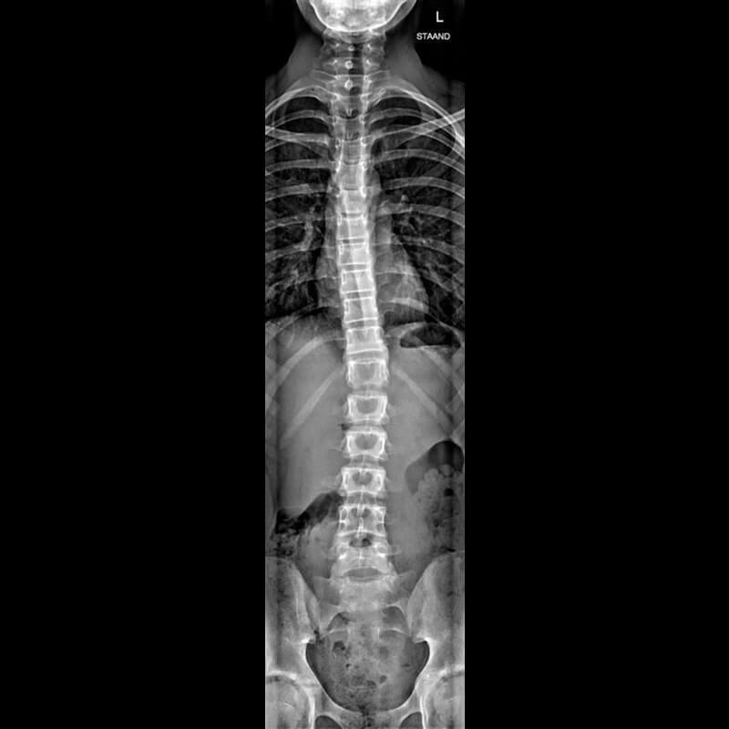 Clinical Image Gallery - Canon Medical Components Europe