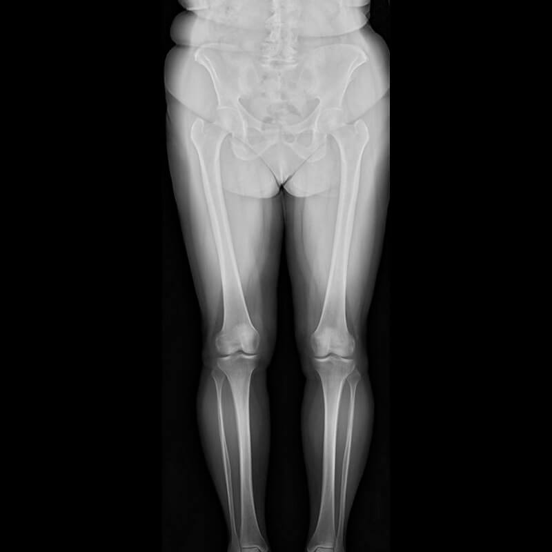 Clinical Image Gallery - Canon Medical Components Europe