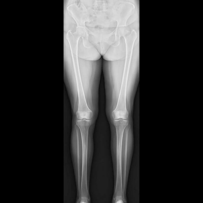 Clinical Image Gallery - Canon Medical Components Europe