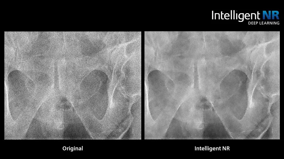 Canon CXDI-420C Fixed Wireless X-ray Detectors - Canon Medical ...