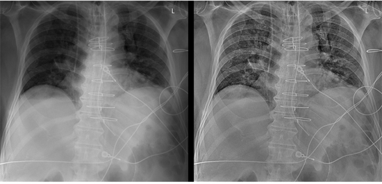 Canon CXDI Control Software NE - Canon Medical Components Europe