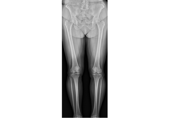 Canon CXDI Control Software NE - Canon Medical Components Europe