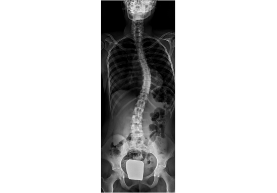 Canon CXDI Control Software NE - Canon Medical Components Europe