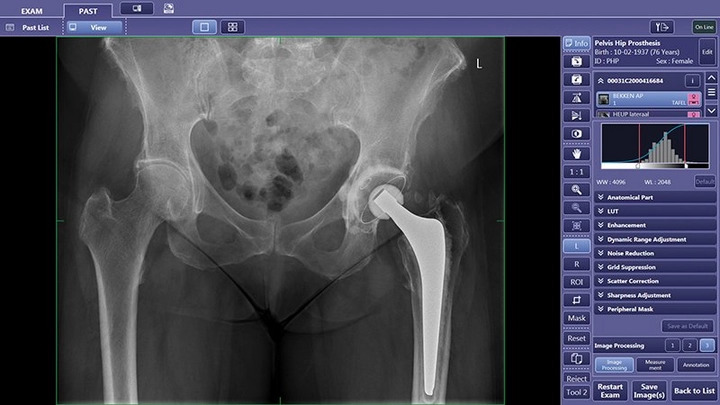 Canon CXDI Control Software NE - Canon Medical Components Europe