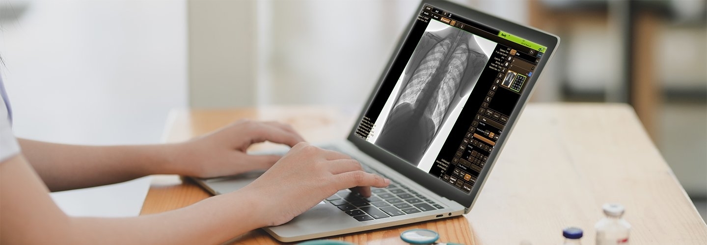 Canon CXDI Controller RF Software - Canon Medical Components Europe