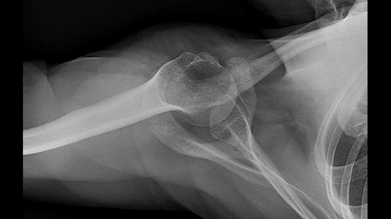 Canon Wireless CXDI-720C Flat Panel Detectors - Canon Medical ...