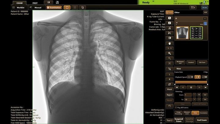 Canon CXDI-RF B1 Dynamic Flat Panel Detectors - Canon Medical ...