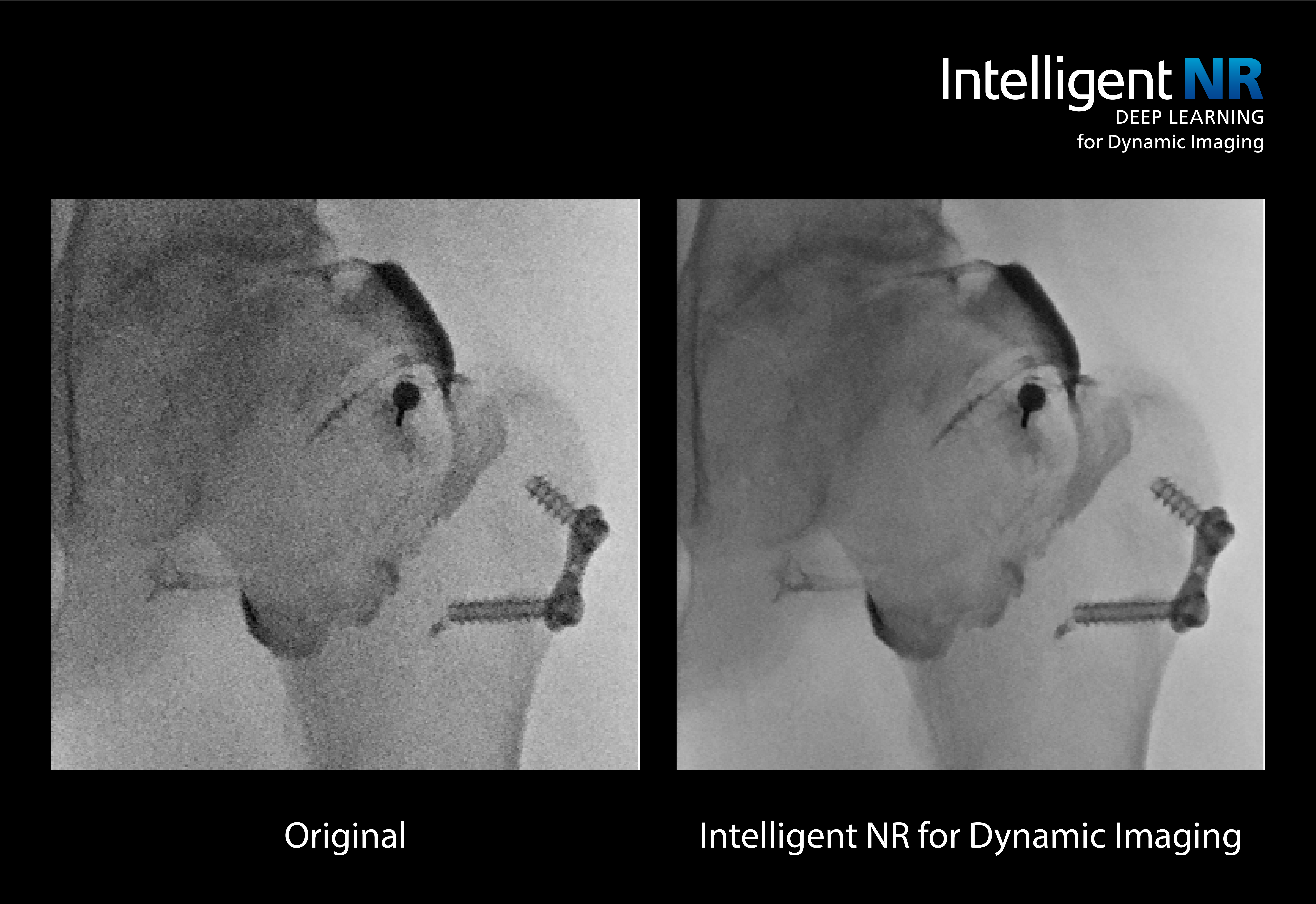 Canon CXDI-RF B1 Dynamic Flat Panel Detectors - Canon Medical ...