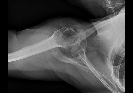 Canon Digital Radiography Solutions - Canon Medical Components Europe