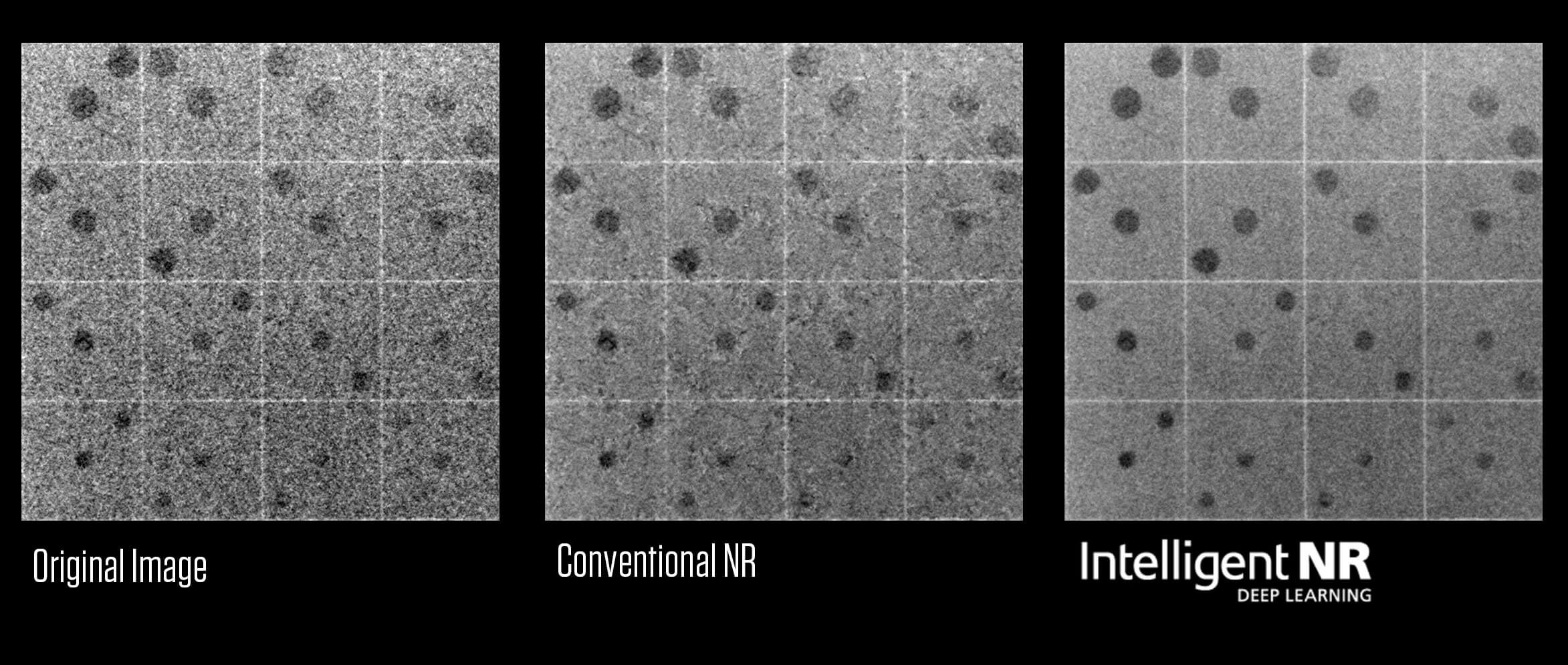 Canon intelligent-noise-reduction - Canon Medical Components Europe