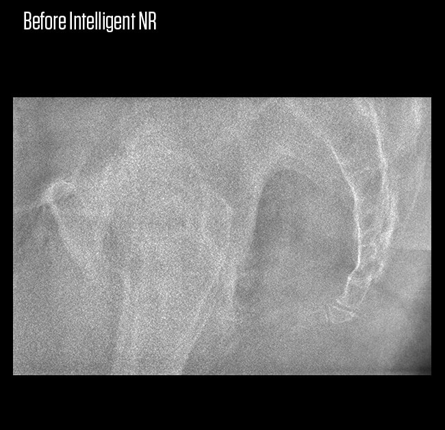 Canon intelligent-noise-reduction - Canon Medical Components Europe