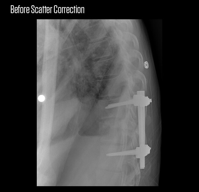 Canon Scatter Correction - Canon Medical Components Europe