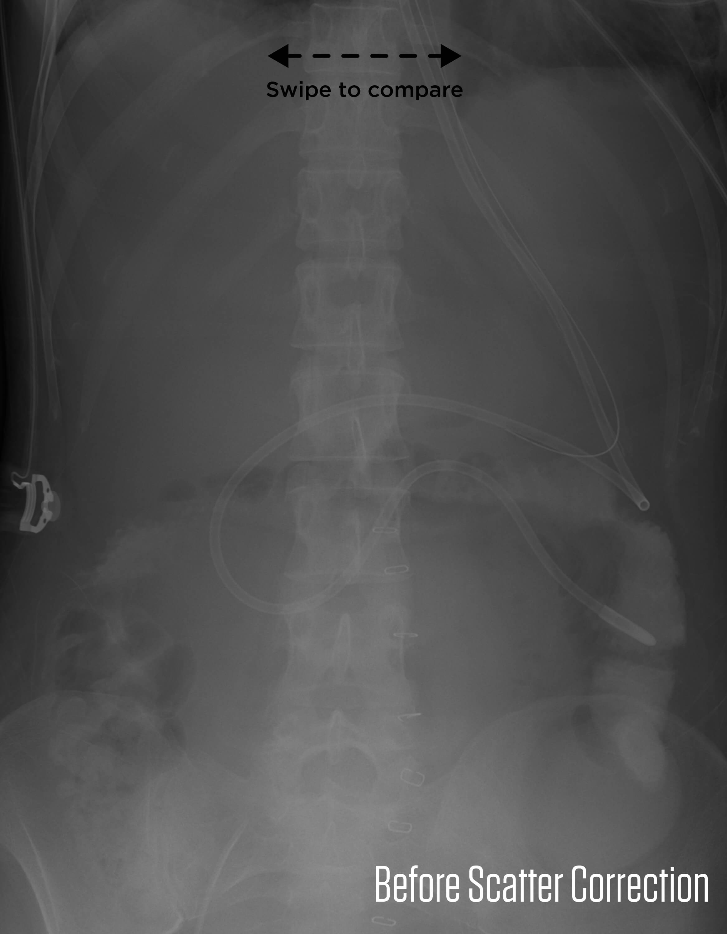 Canon Scatter Correction - Canon Medical Components Europe